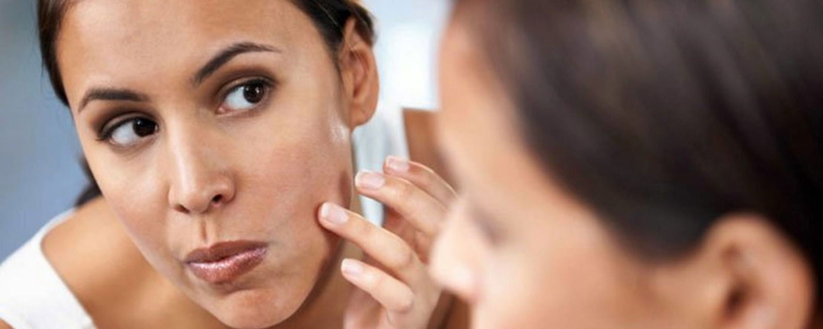 Kenali Cloasma Gravidarum, Salah Satu Masalah Utama Saat Hamil