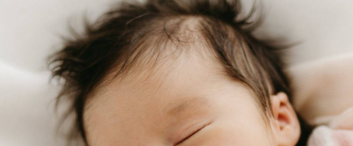 How To Prevent Baby Hair Loss in 7 Ways