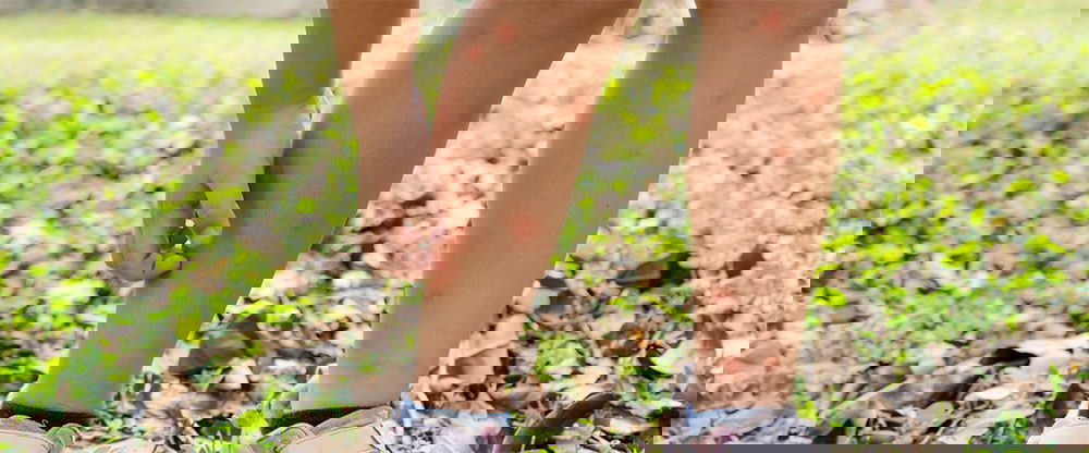 Are Mosquito Repellents With DEET Safe for Babies?