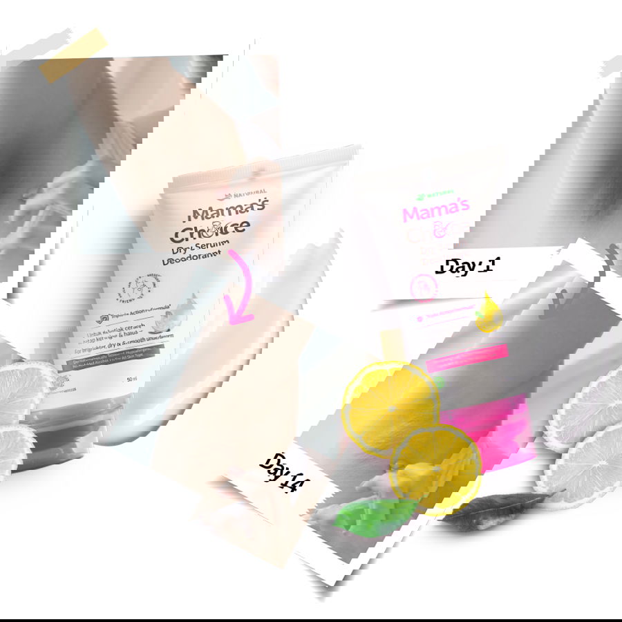 Pampaputi Ng Kilikili: 4 Na Tips Para Sa Mga Bagong Panganak