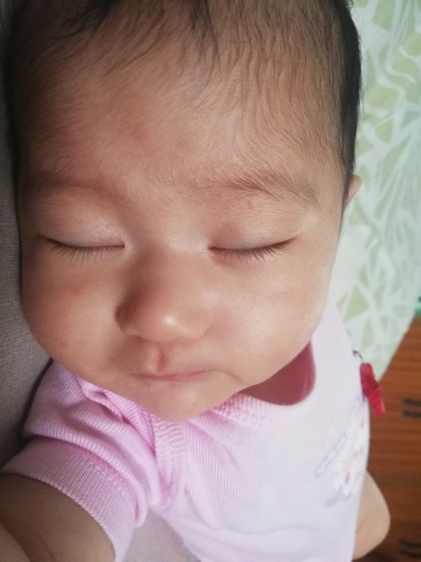 Butlig Sa Face Ni Baby Hi mga momsh. Ask lang po kung ano po