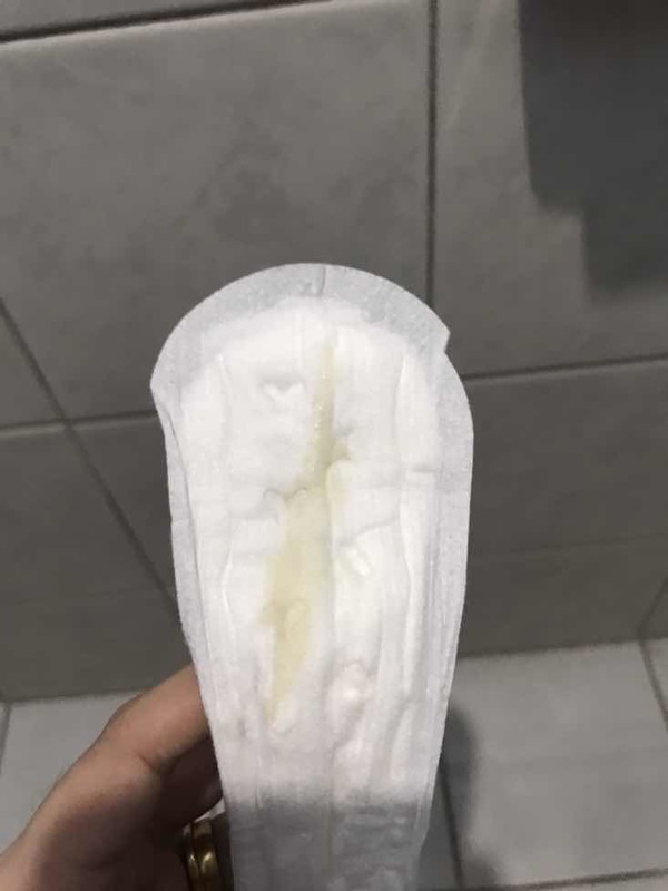 Discharge 15 weeks na po ako. Ok lang po ba yung discharge k