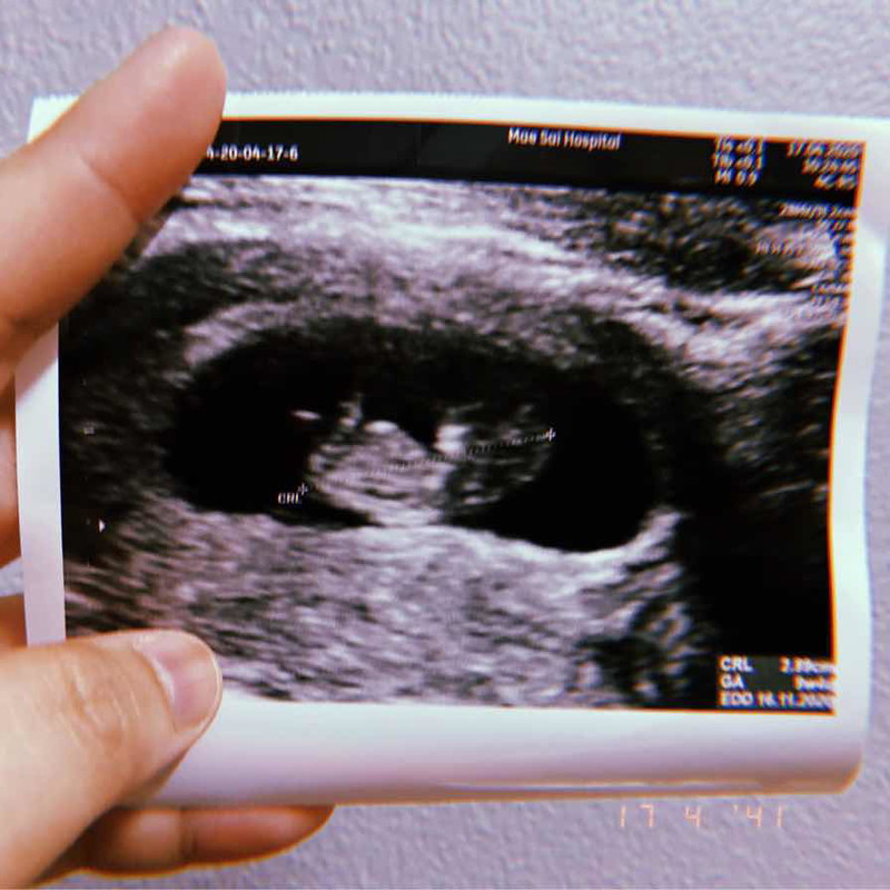 9w5d ต้าวความรักของแม่ๆ ดิ้นใหญ่เลยเชียว