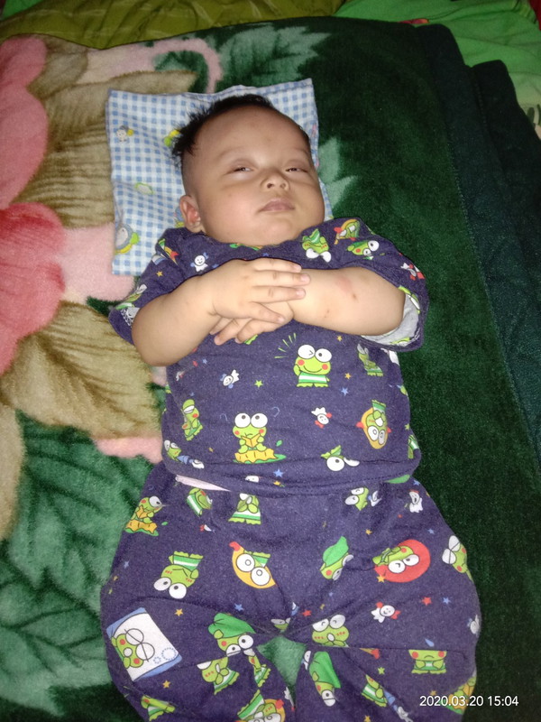 Ini gimana cara ngilanginnya Bun ank saya di gigit nyamuk or