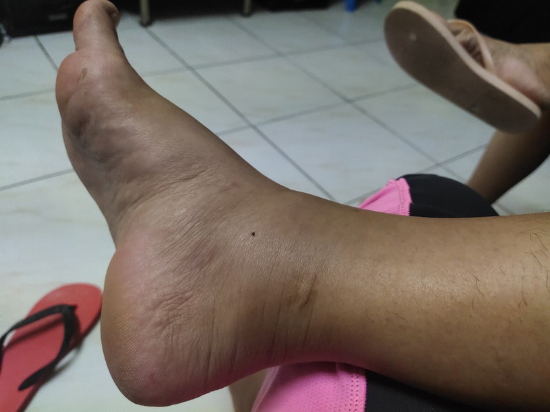 Anu po yong BERI BERI? sino po may alam kong anu yong beri b