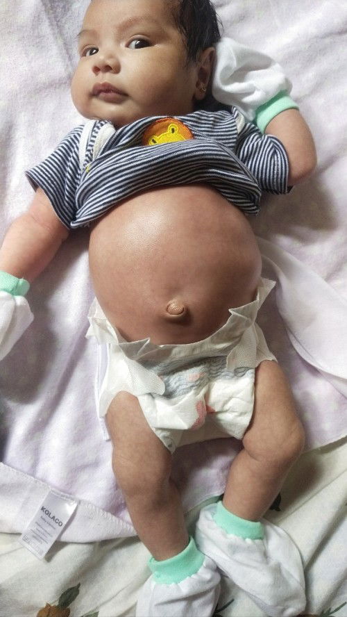 Malaking tiyan Mga mommy pahelp naman po . FTM . Normal lang