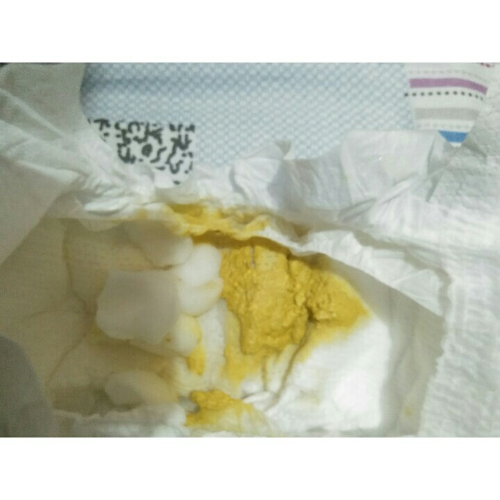 Poopy Moms! Worried lng ako sa baby ko normal po ba yun ever