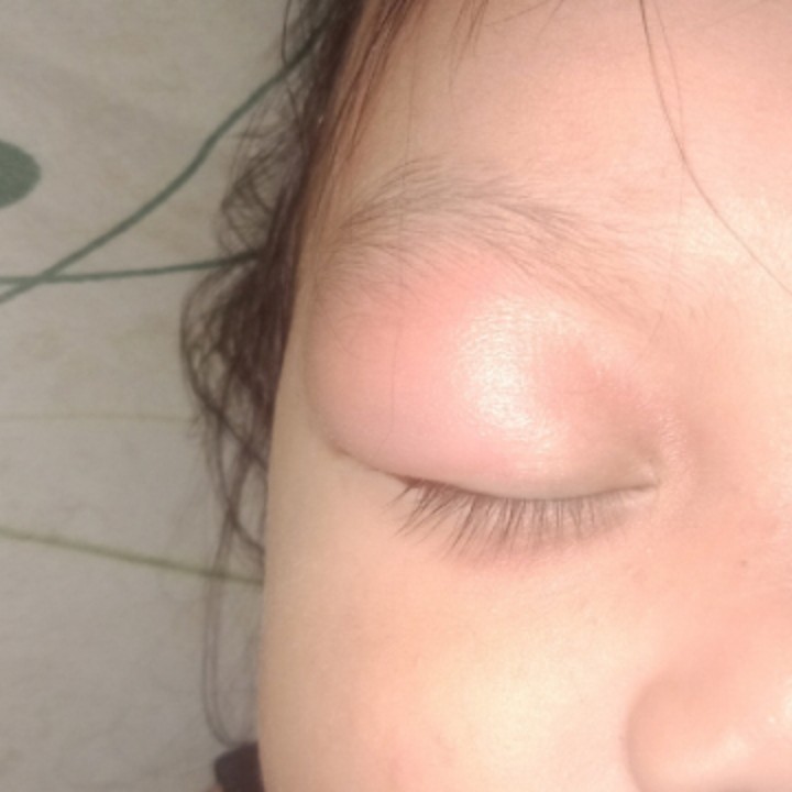 ANO PONG GAMOT SA NAMAMAGANG MATA NG BBY NAKAGAT PO ATA N