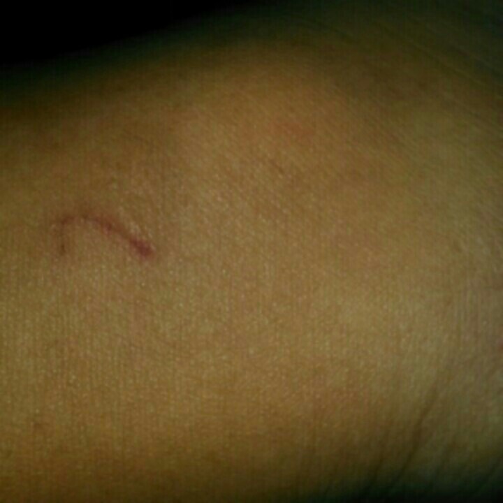 kalmot ng pusa hi mga mommies ! i'm 38 weeks pregnat na po