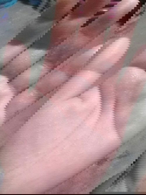 Butlig butlig Momhs anu kaya ito sa kamay ko sobrang kati ny