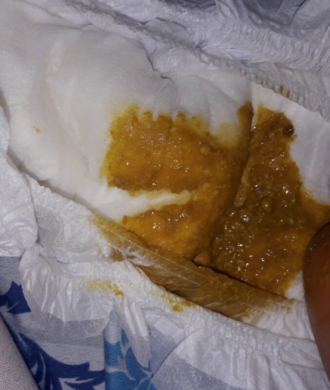 baby poop(sorry s picture) sno po ang gnito dumi ng mga baby