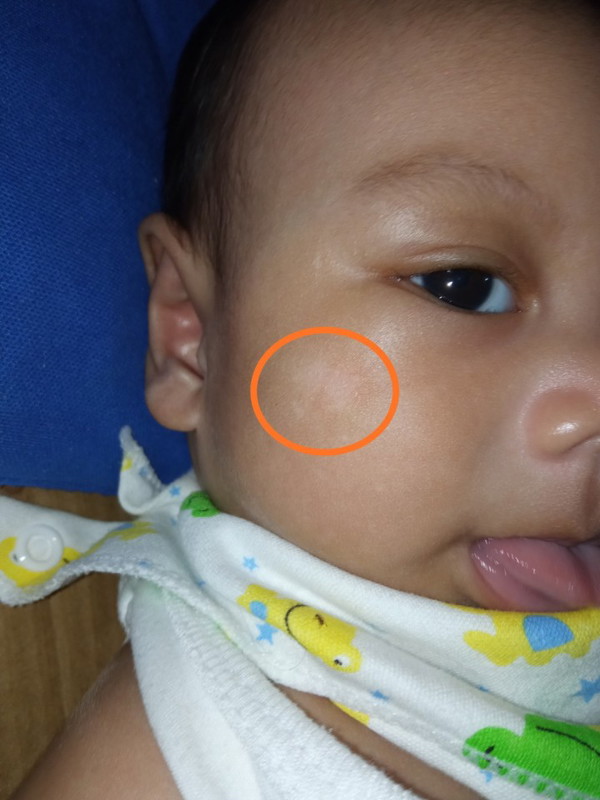 Puti puti Ano po tong puti puti sa mukha ng baby ko meron di