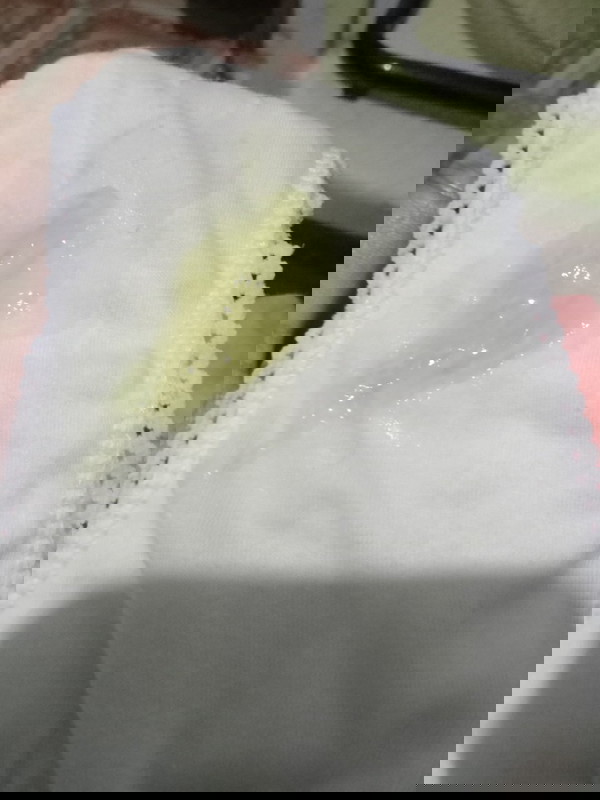 Sticky Discharge Mga momsh. Ano ba to? Eto nba ung mucus plu