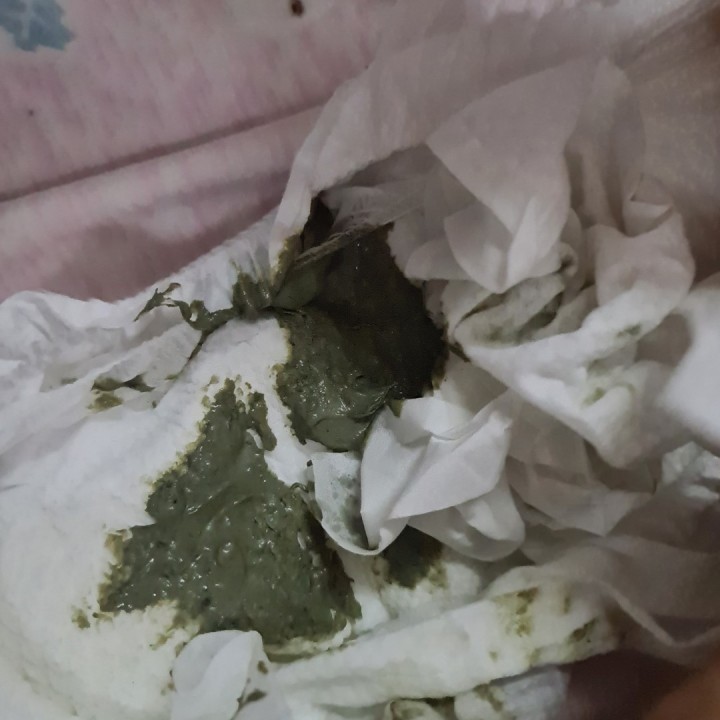 Dark grey/green poop 8 mths Is it a concern that my baby alw