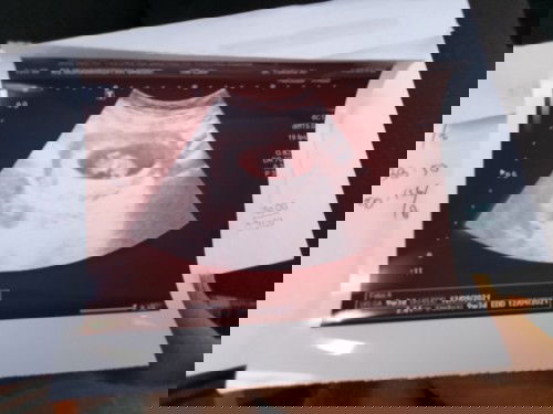 Usia kandungan 9 Minggu Mom usia 9 Minggu dengan gambaran ja