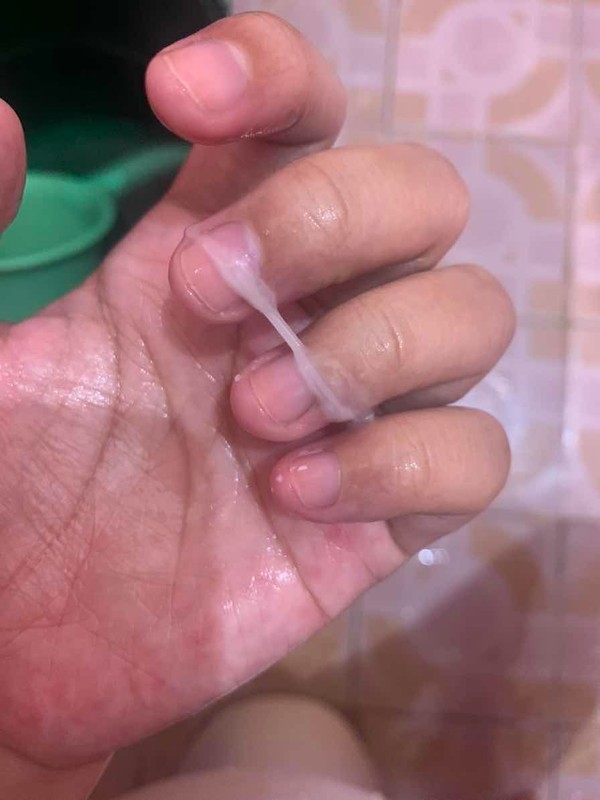 Mucus Plug Need Help 30weeks Pregnant Po Ako Ftm Mucus