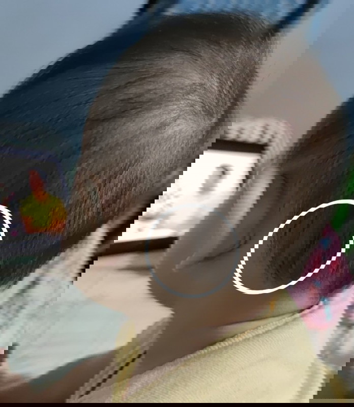 Bukol sa ulo ni baby Hi po 🥺 Ask ko lang po ano po kaya yung