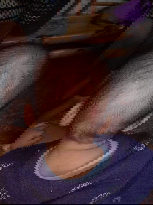 butlig na may nana sa ulo ni baby moms ano po kaya tong na s