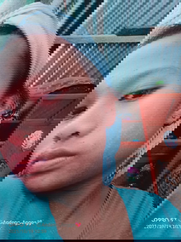 An-an/kamanaw sa mukha Ano po Ang maaring gamot sa an-an sa