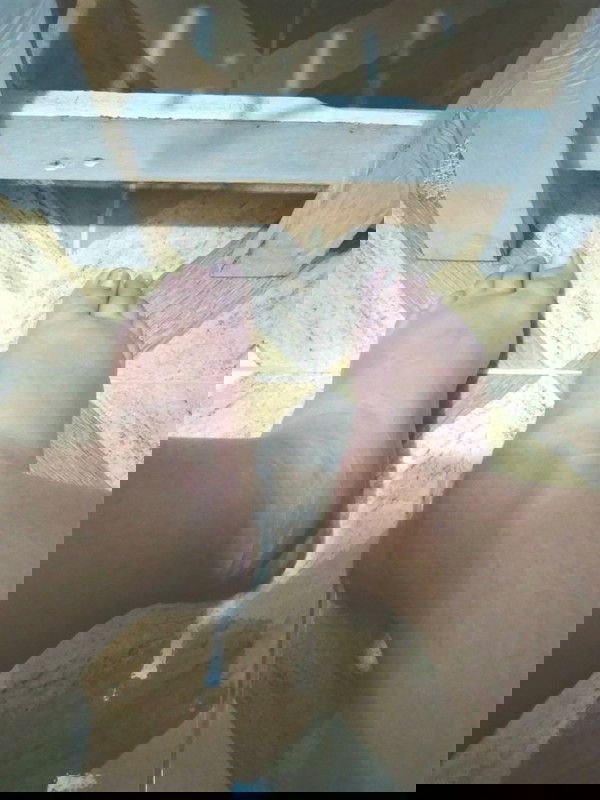 Manas sa Paa Normal po ba na medyo masakit at medyo namumula