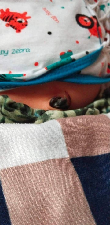 Pusod ni baby Normal lang po bah na nagdudugo ng kaunti ung