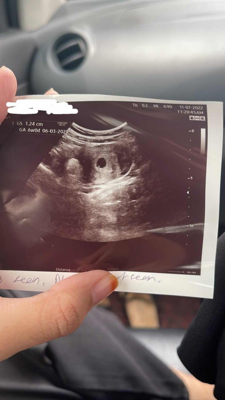 5weeks2days scan Tadi gi scan, kalau ikut size kantung, kand