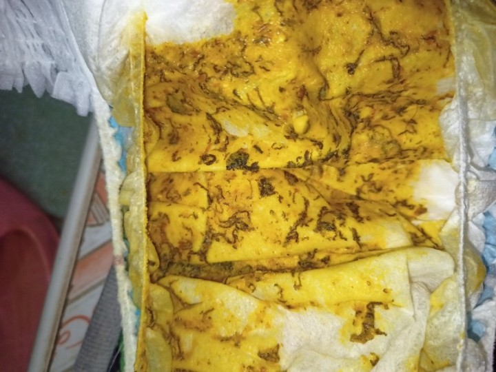 Itim itim sa popo Ftm po. Bakit po kaya ganito poop ni lo 🥺