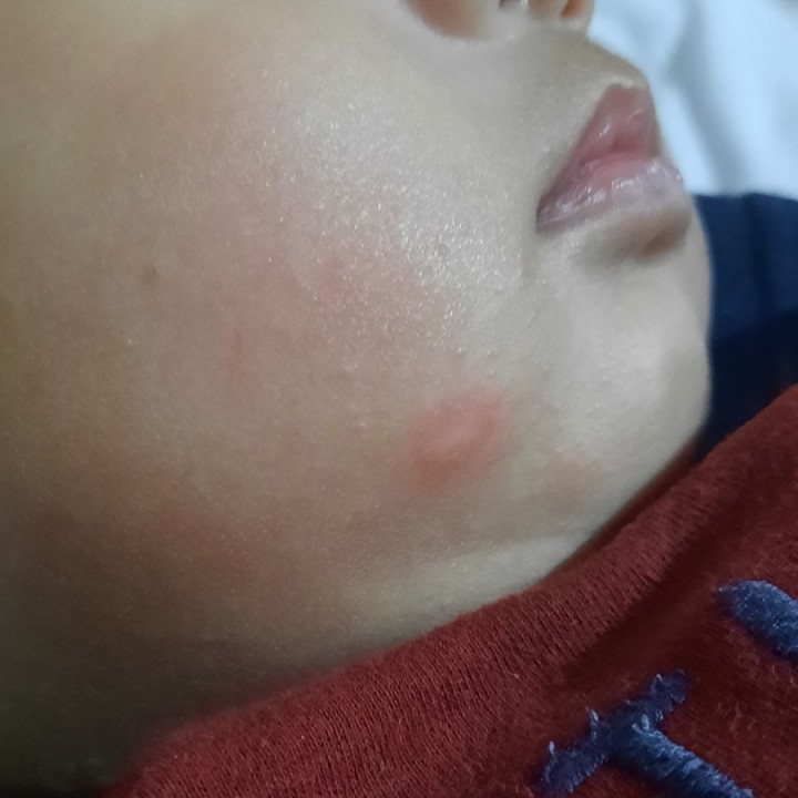 Ano po kaya ito.? Hi po ftm here. Normal na rashes po ba ito