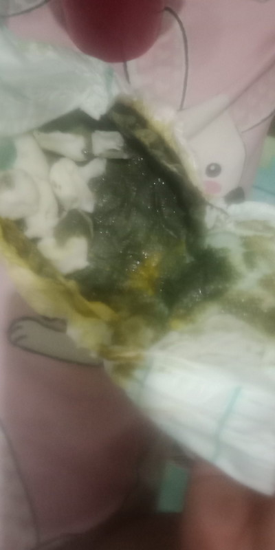 3days bago maka poop si baby Ito po kulay ng poops ni baby