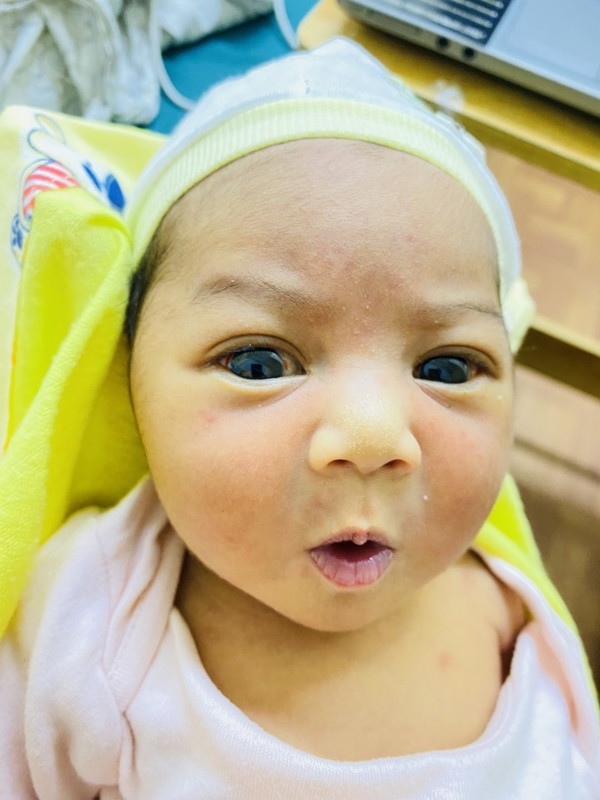 Ano po ung parang red line sa gilid ng mata ni baby Paano po