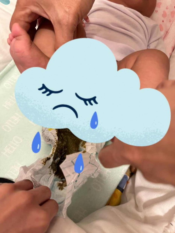 Dark green poop for pure breastmilk Hi mommies. Pasintabi po