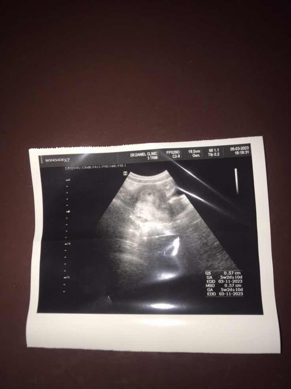 ซาว์ดเจอตอนกี่w ในนี้บอก6w4d ไปอัตราซาว์ดมาหมอบอก5w อันไหนตร