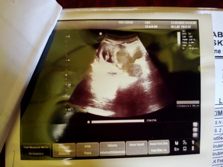Hasil USG 7 minggu Bunda mau tanya dong Bun, kemarin habis U