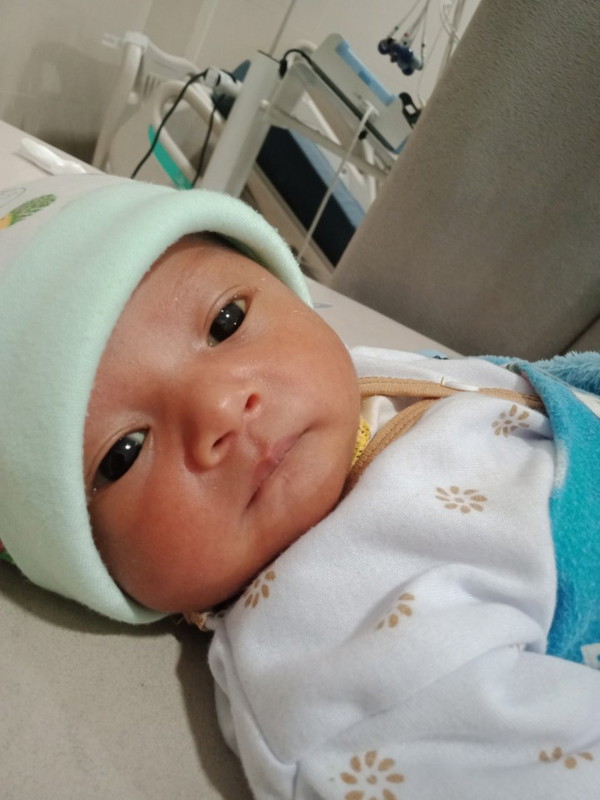 BAYI KUNING Ini bayi kuning yang diceritain. Setelah bingung