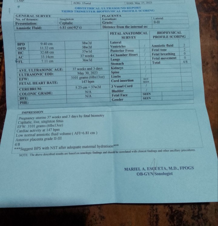 BPS Ultrasound Ask ko lang po if maganda yung result ng BPS