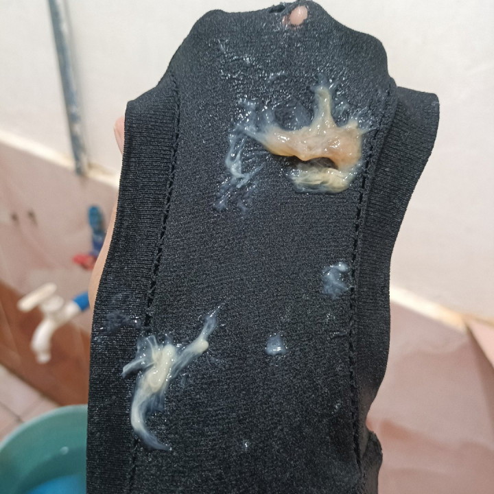 Mucus Plug mga momsh ito na un diba? ang mucus plug po.. day