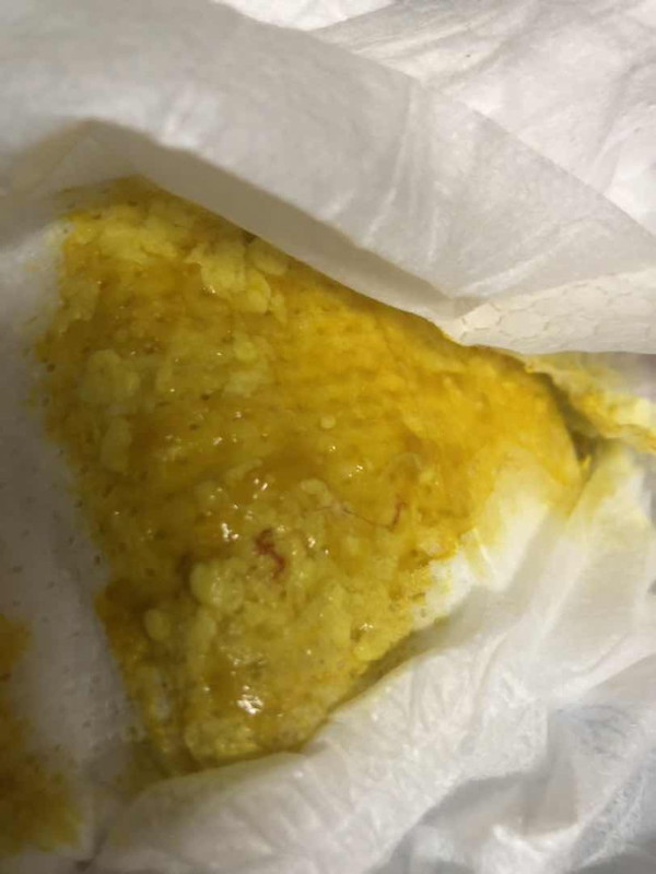 Berak darah Sorry gambar berak. Baby sy 3 bulan lebih, nak m