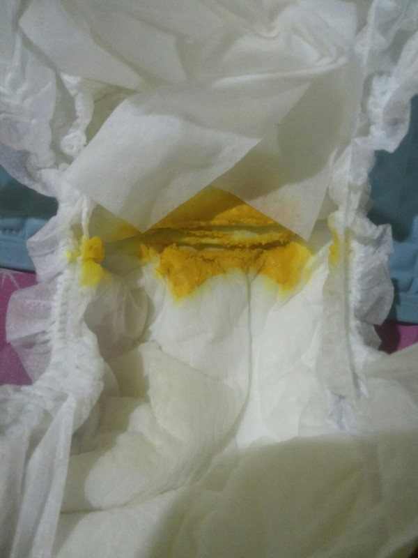 First mom ( tahi baby ) Normal ke colour tahi baby macam ni