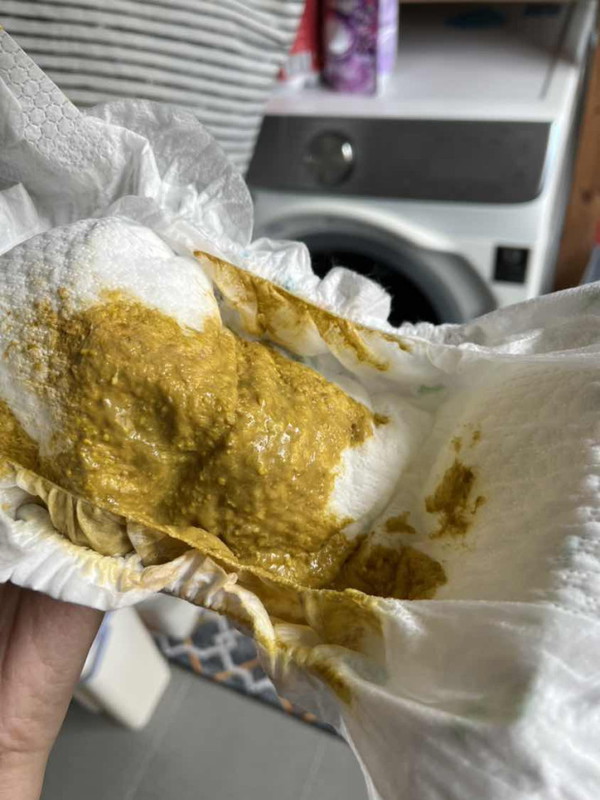 Baby diarrhoea or normal? Baby is fully formula fed, a month