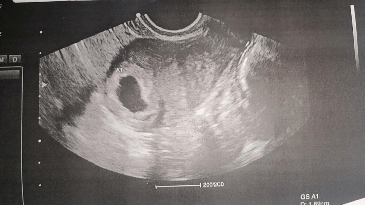 ซาวกันกี่วิคถึงเจอน้องคะ บ้านนี้9w4d ยังไม่เจอตัวน้องเลย เจ