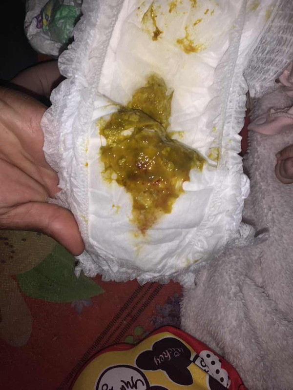 Anak pup terus dan berlendir Mom ada yang tau ga, bayi ku as