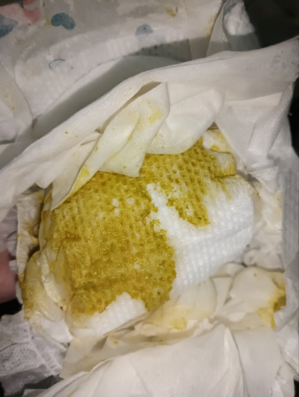 Cirit birit atau tidak? Saya nak tanya kemarin anak saya dem