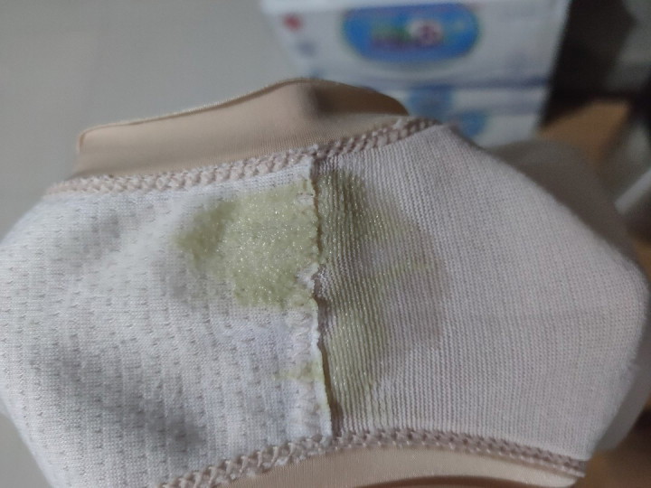 KEPUTIHAN WARNA SEPERTI INGUS Maaf aybun,. Apakah disini ada