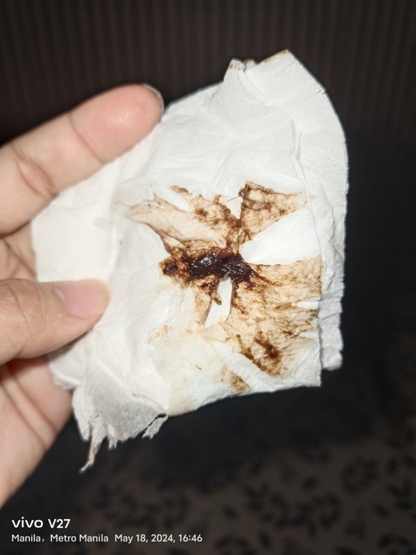 Discharge for 22weeks😔 Alam ko pong di normal Ang brown disc