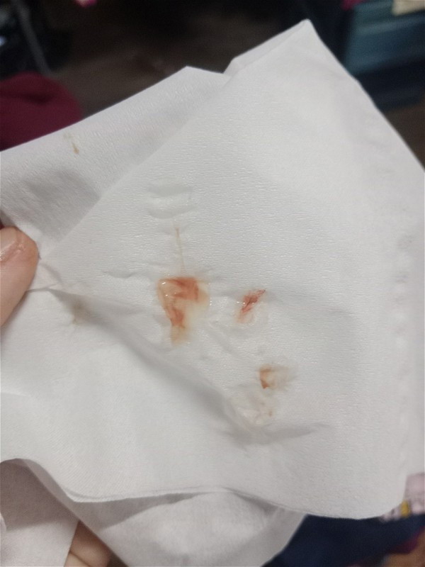 ตั้งครรภ์ 6w5d ตั้งครรภ์ 6w5d มีมูกปนเลือดแบบนี้อันตรายมั้ยค