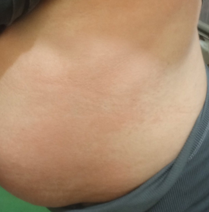 Rashes after giving birth Hello mga mommies . Sino po nkara