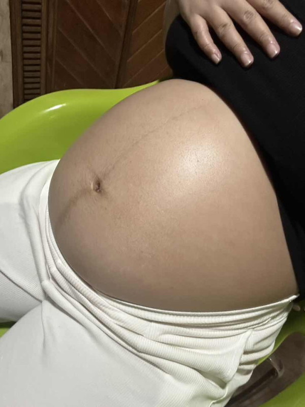 Hi mga mima, malaki n ba tiyan nyo? Im 26wk3d Hi mga mii, ka