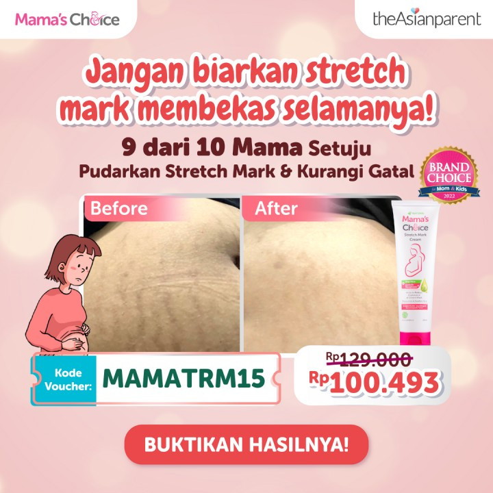 JANGAN LAKUIN INI, BIKIN STRETCH MARK GAK HILANG! 😱 Parents,