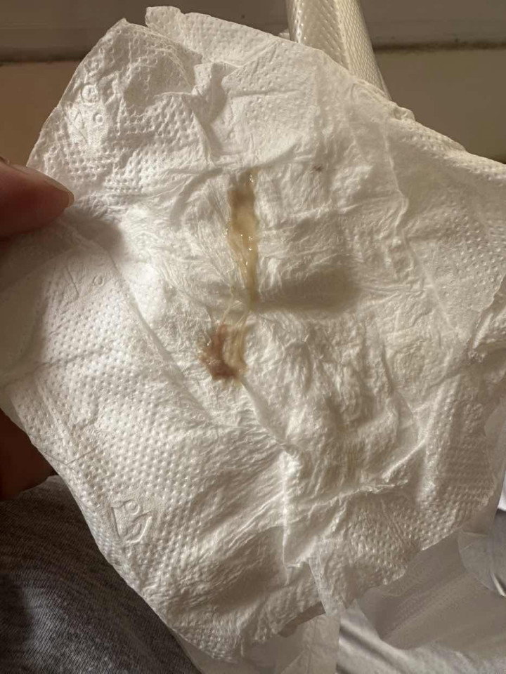 What is this ???? Helpp Hello mommies , Im 34 weeks pregnant