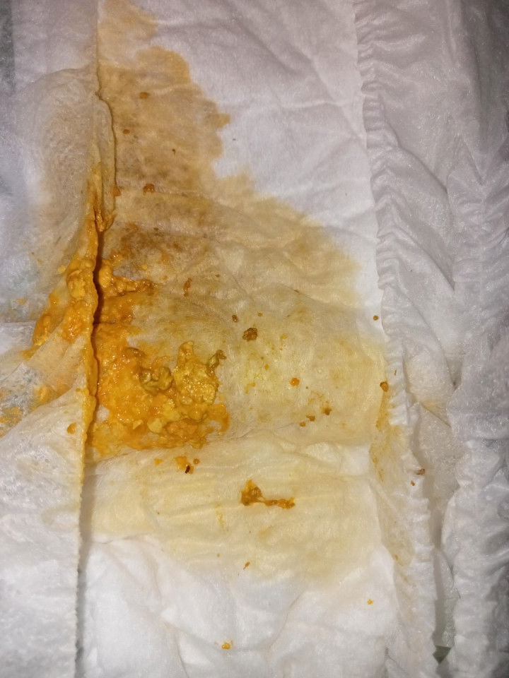 Pup bayi usia 20 hari Maaf jorok, bund normal gasi klo pup b